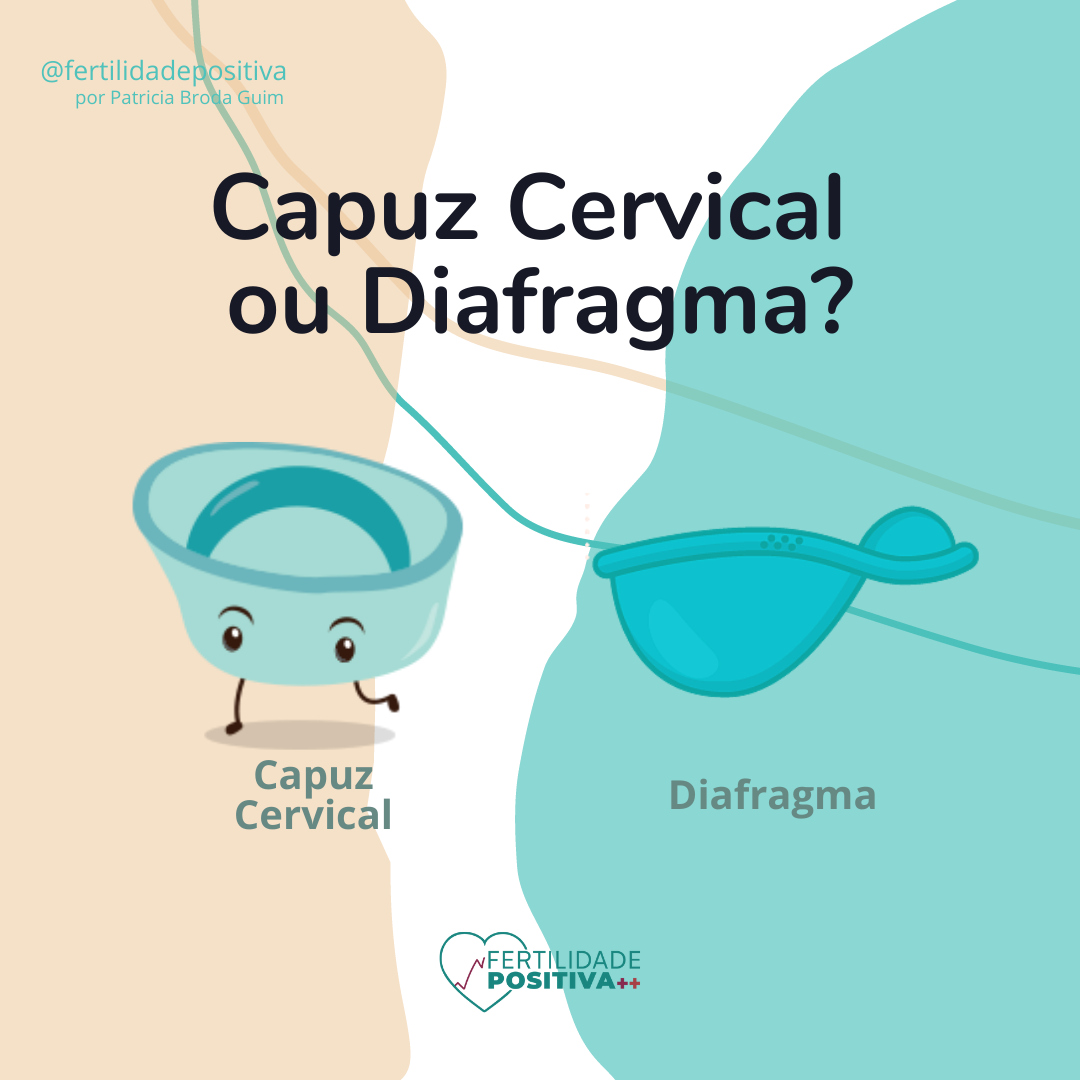Diafragma, Capuz Cervical E Escudo Cervical Coleira Cervical Universal